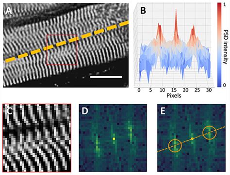 Frontiers Quantification Of Myocyte Disarray In Human Cardiac Tissue