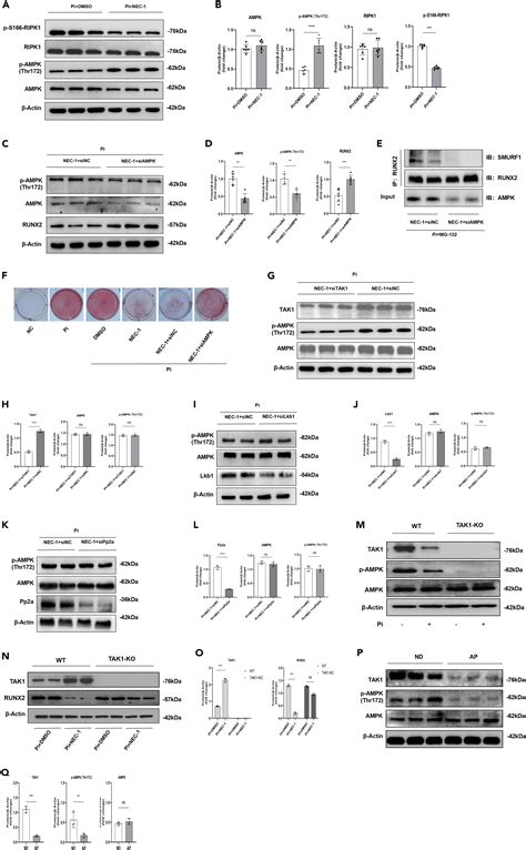 Inhibition Of Ripk1 Alleviating Vascular Smooth Muscle Cells Osteogenic Transdifferentiation Via