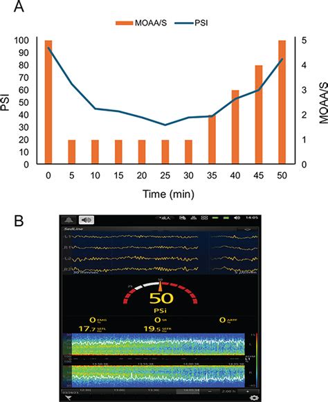 Evaluating Sedation Depth Using Patient Status Index In Elderly Patien Cia
