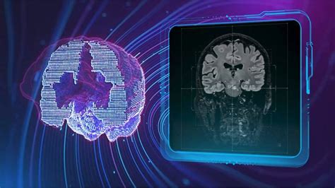 Ge Healthcare On Linkedin Aitechnology Healthcaretech Machinelearning Cloudcomputing…