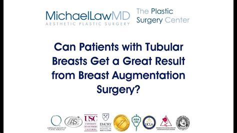Can Patients With Tubular Breasts Get A Great Result From Breast