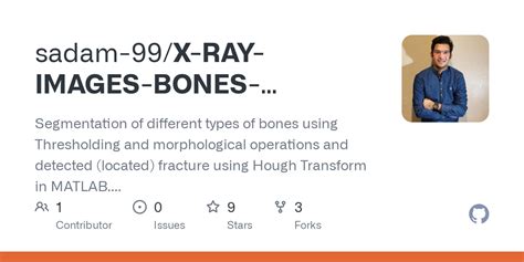 Github Sadam 99x Ray Images Bones Segmentation And Fracture Locator