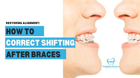 Restoring Alignment How To Correct Shifting After Braces Virginia Braces