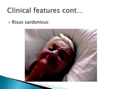 Tetanus Prophylaxis And Types Of Immunitynewnewv Pptx Infectious Diseases Diseases And