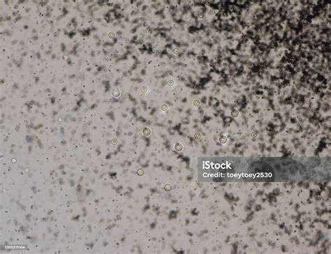 Cryptococcus Neoformans Is An Encapsulated Fungal Organism And It Can Cause Disease In