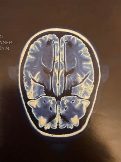 My Brain Scan Came Back Positive Im Officially The Crazy Cat Lady