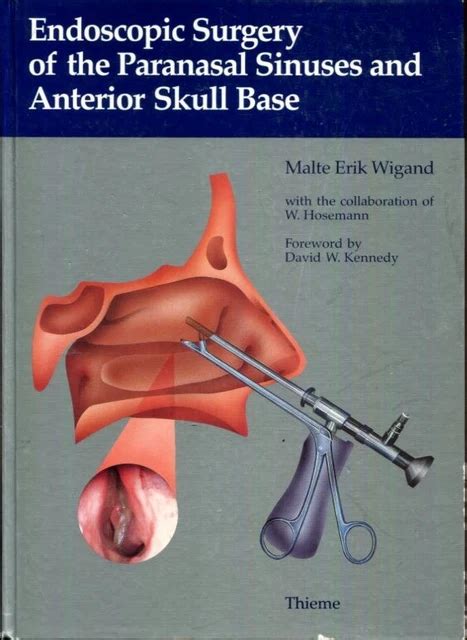 Endoscopic Surgery Of The Paranasal Sinuses And Anterior Skull Base £48
