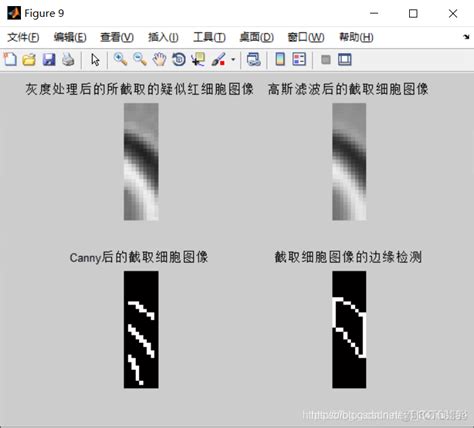 【细胞识别】基于matlab细胞识别和边缘检测【含matlab源码 210期】51cto博客matlab细胞分割