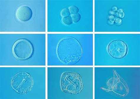 Reproduction Development The Purple Sea Urchin