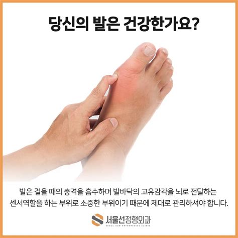 서울선정형외과 발은 자세를 형성하는 중요한 기준점이 되기 때문에 발이 틀어질 경우 골반과 체형이 틀어질 수 있으며 조금만 걸어도 발이 아프고 서 있을때와 걸을 때