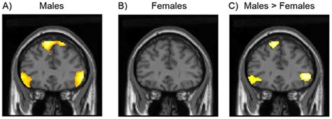 Brain Activation During Approachability Judgements In A Males And B