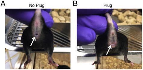 Modeling Autism Related Disorders In Mice With Maternal Immune