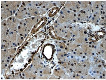 Anti PDGFR Alpha Antibody RM0004 3G28 Ab51875 Abcam