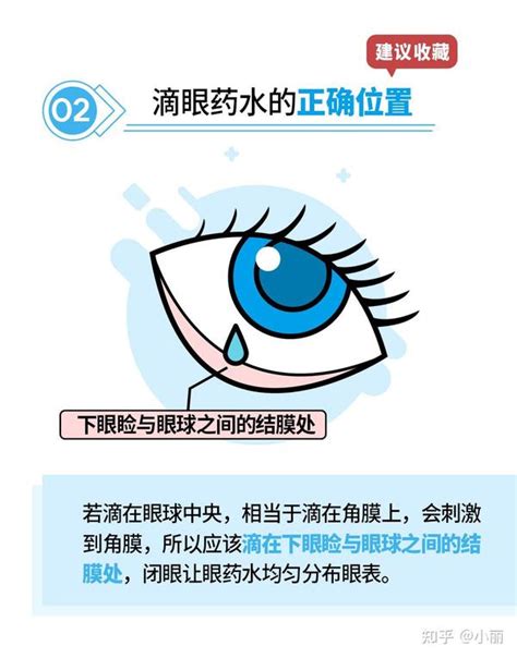 眼药水的正确用法 知乎