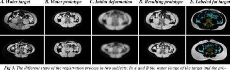 Figure 3 From Quantitative Abdominal Fat Estimation Using Mri Semantic Scholar