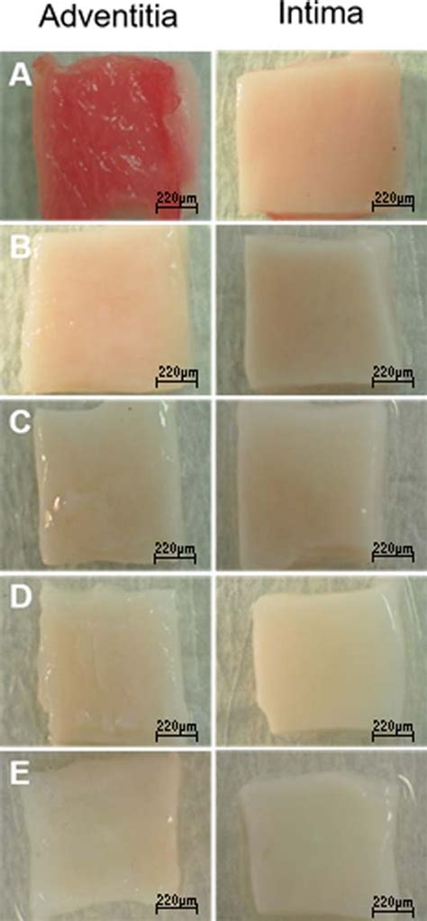 Figure 1 From Improvement Of Decellularization Efficiency Of Porcine