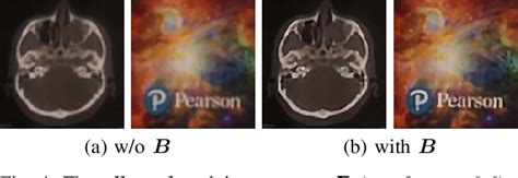 Figure 1 From A Multiframe Super Resolution Pipeline For Sub Image Typed Light Field Data