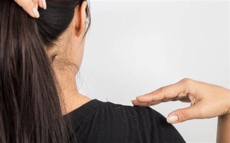 Forfora Grassa Come Riconoscerla Gestione E Soluzioni Galenia