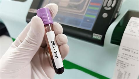 Anemia Normocytic Anemia My Nutrition Rx