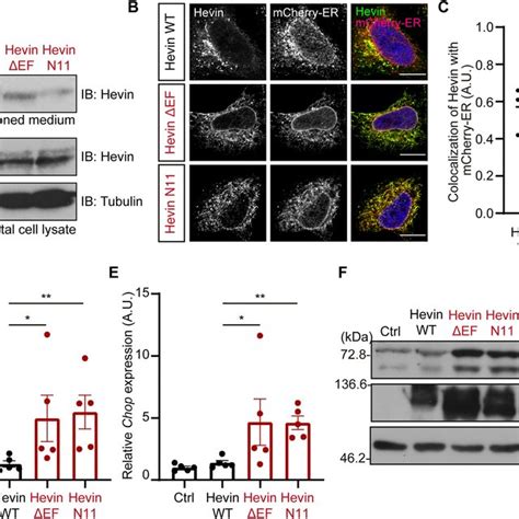 Hevin Mutants Lacking The Ef Hand Motif Are Generated In The Download Scientific Diagram