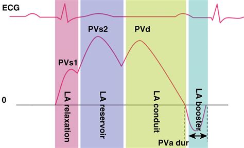 Echo Doppler Parameters Of Diastolic Function Clinical Tree