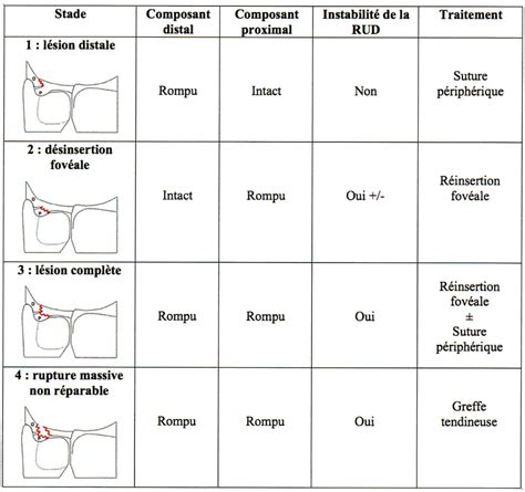 Ligament Tfcc Le Docteur Charles Bijon à Paris