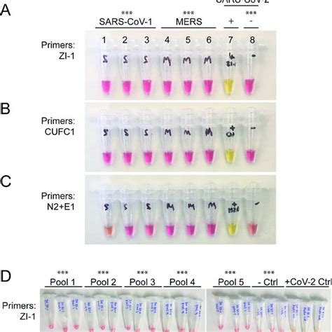 Loop Mediated Isothermal Amplification Lamp Detection Of Sars Cov 2