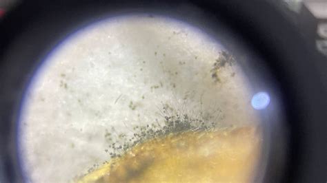 Abhishek Subedi On Linkedin Diagnosed Bipolaris And Curvularia On Different Genotypes Of Seed