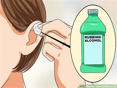 Drain Cauliflower Ear Without Syringe At Anne Rodriquez Blog