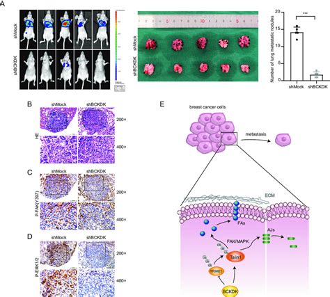 Bckdk Promotes Brca Metastasis In Vivo A Luciferase Labeled Mda Mb 231