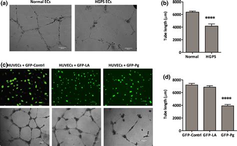 Capillary‐like Microvascular Network Formation Defects In Hgps