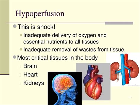 Ppt Shock Circulatory System Overview And Shock Pathophysiology