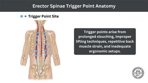 Trigger Point Therapy Erector Spinae Back Erector Spinae And More