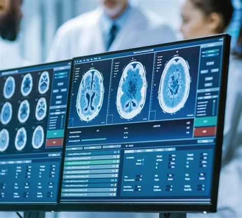 Transforming Dementia Detection Using Documentation