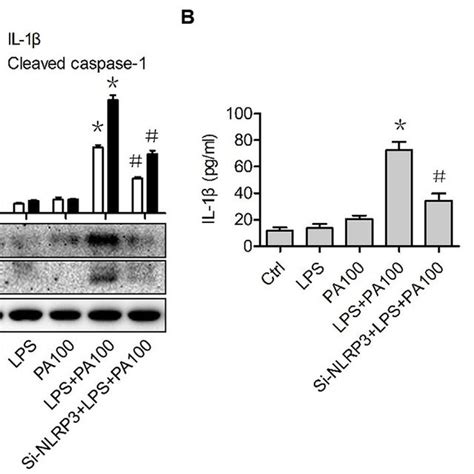 Nlrp3 Inflammasome Inhibition Downregulate Il 1β Expression Induced By