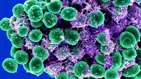 El Chip Que Detecta Una Peligrosa Bacteria Patógena Hospitalaria Infobae