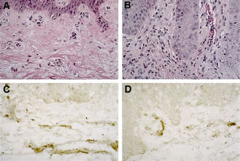The Deposition Of Murine Complement On Dermal Microvessels In Human Download Scientific Diagram