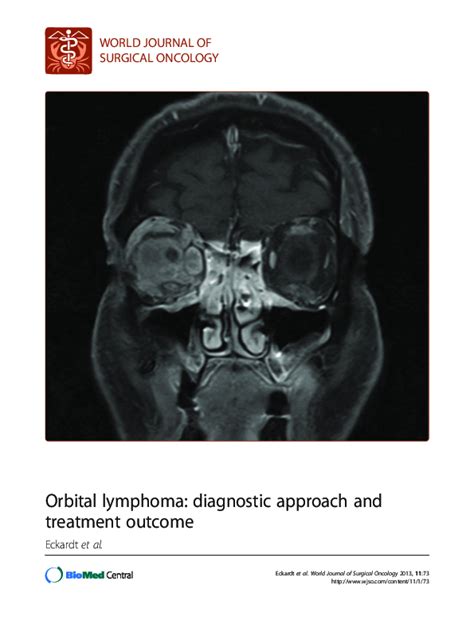 Pdf Orbital Lymphoma Diagnostic Approach And Treatment Outcome