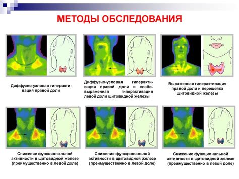 Патофизиология щитовидной железы - online presentation
