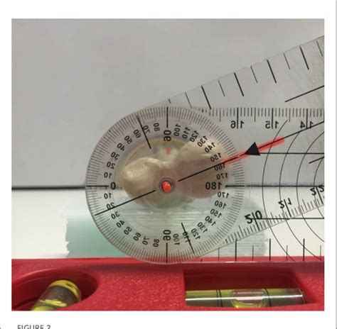 figure 2 from computed tomographic angular measurements using a bone