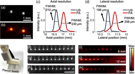Performance Metrics Of Customized Transducer A Ultrasound Image Of