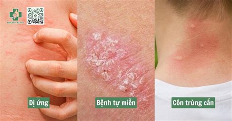 Da N I M N Ng A Nh M N L B L M Sao V C Ch X L