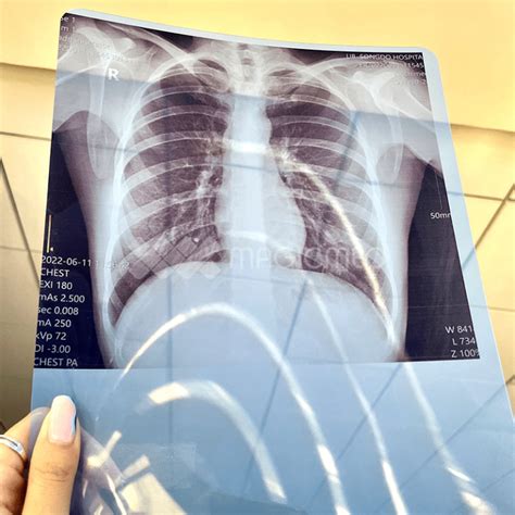 Рентген зургийн хальс Мэйжик Мед