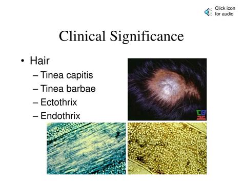 Ppt Mycology Dermatophytes Powerpoint Presentation Free Download