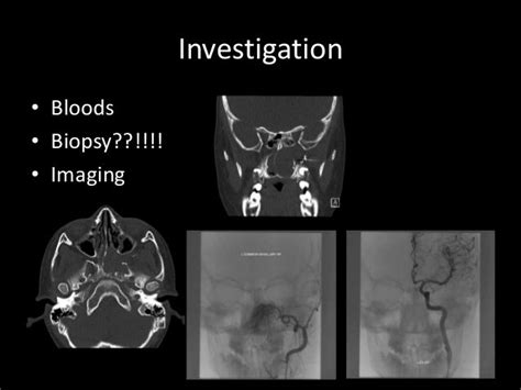 Jna Reg Presentation