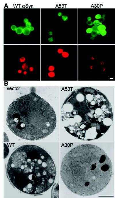 Yeast Cells Provide Insight Into Alpha Synuclein Biology And Pathobiology Pmc