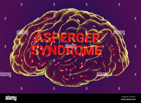 A Conceptual 3d Illustration Featuring The Text Asperger Syndrome