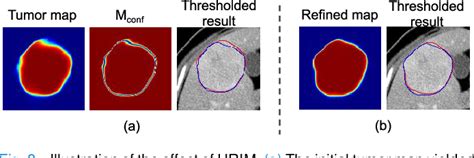 Figure 1 From Multi Modal Tumor Segmentation With Deformable Aggregation And Uncertain Region