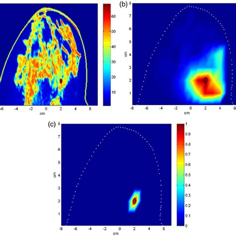 A Dielectric Permittivity ϵr Distribution Of Phantom Id 080304 Download Scientific