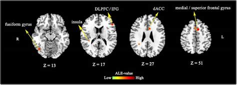 Brain Activation Underlying Emotional Interference Of Cognitive Control